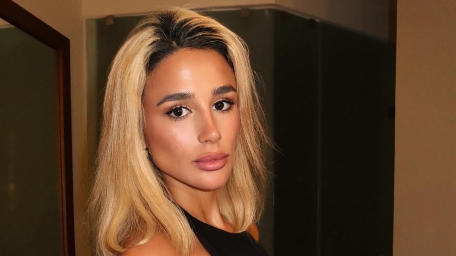 "Guarén" contó todos sus retoques estéticos y reveló dónde "no se ha tocada nada"